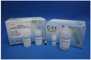 Endotoxin-free Plasmid DNA Extraction Kit for Small-volume Samples ...